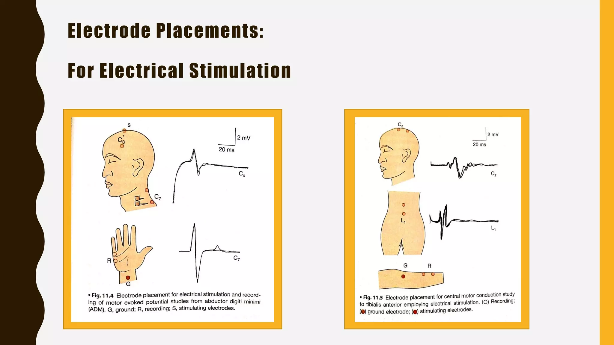 Somatosensory and motor evoked potentials by neelothpala | PDF