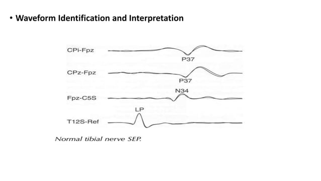 Somatosensory evoked potential | PPTX | Death, Injury, or Military ...