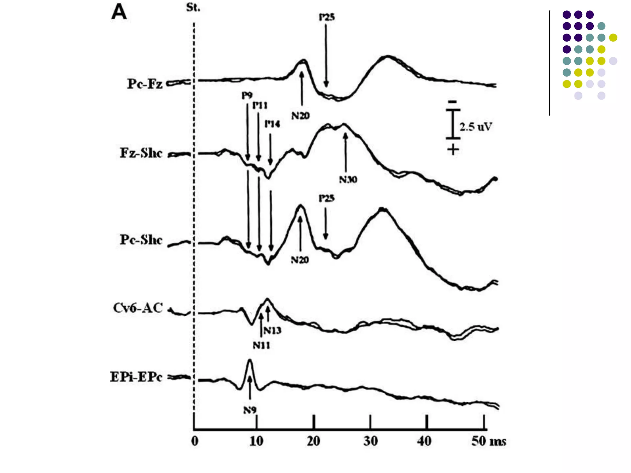 Somatosensory evoked potentials | PPTX