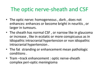 Some problem solving in neuro imaging - Vincent Batista Lemaire | PPTX