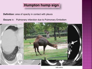 Some radiological sig | PPSX