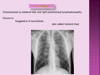 Some radiological sig | PPSX
