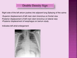 Some radiological sig | PPSX