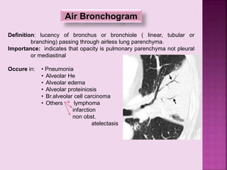 Some radiological sig | PPSX