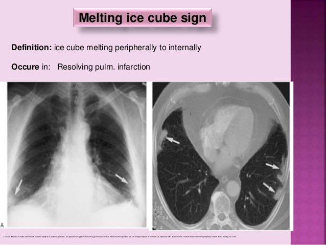 Some radiological sig