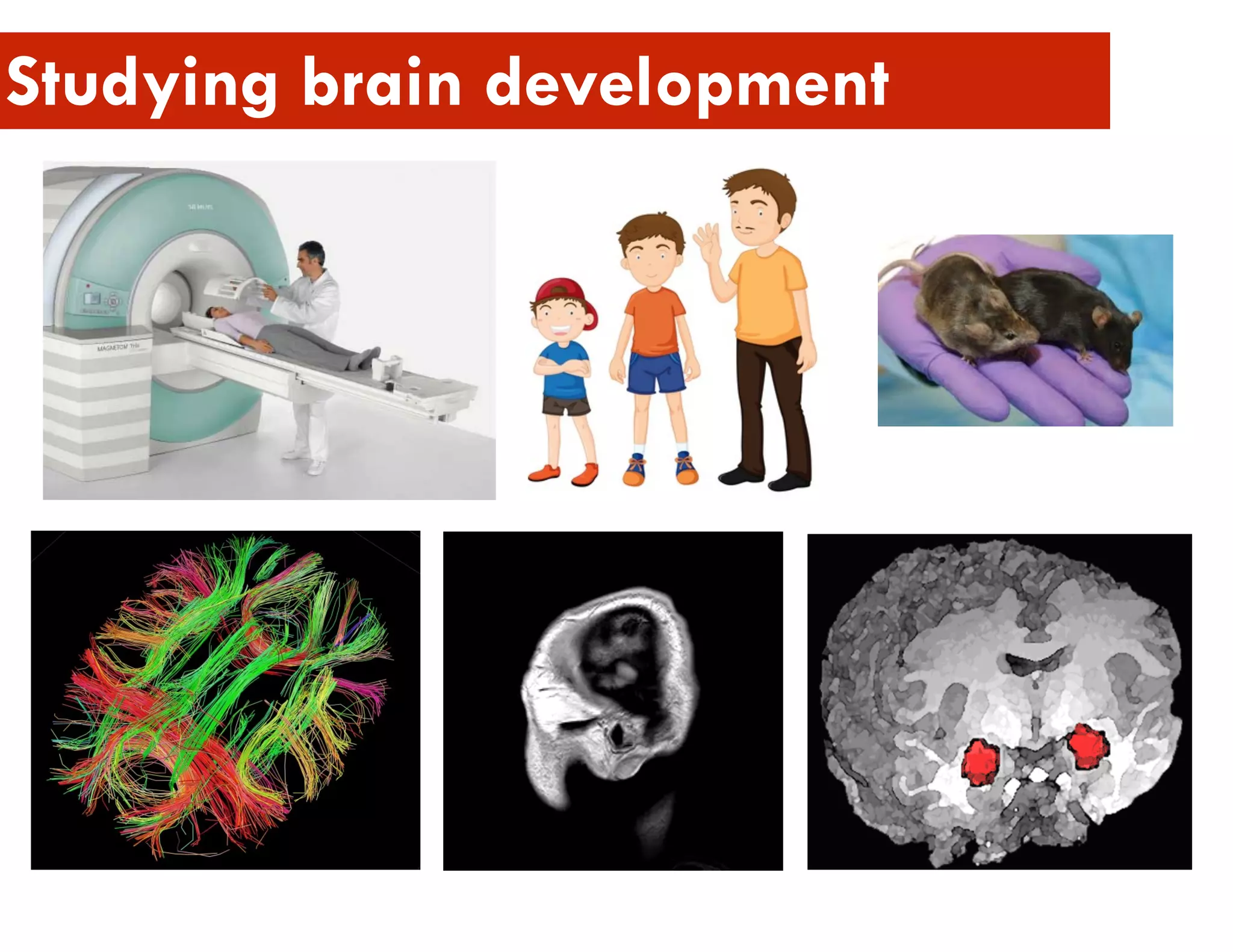 Somerville, Adolescent Brain Development and Psychological Functioning ...