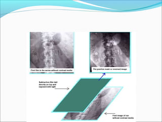 Some special imaging process | PPT