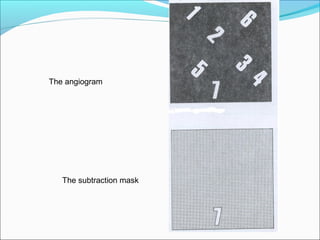 Some special imaging process | PPT