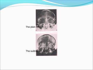 Some special imaging process | PPT