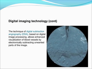 Some special imaging process | PPT