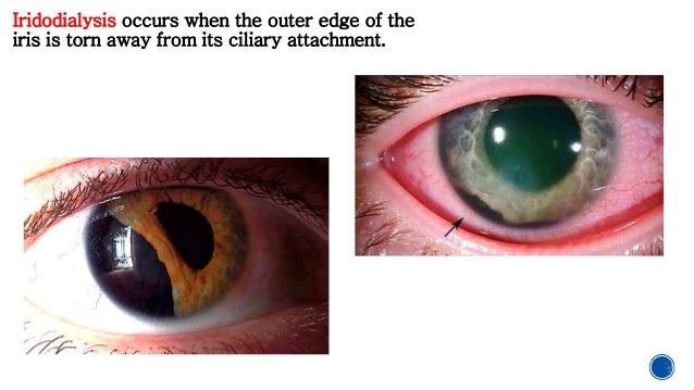 Pupil Basic