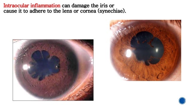 Pupil Basic