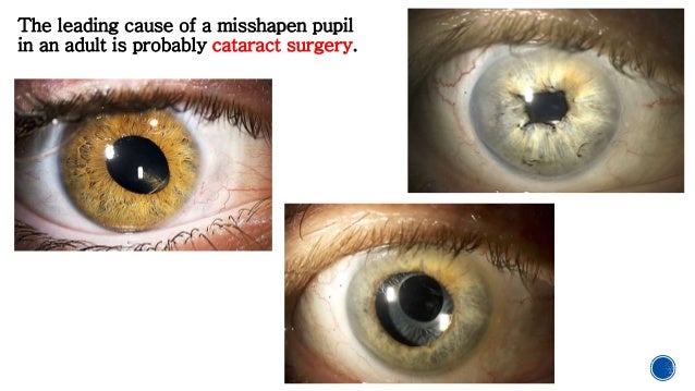 Pupil Basic