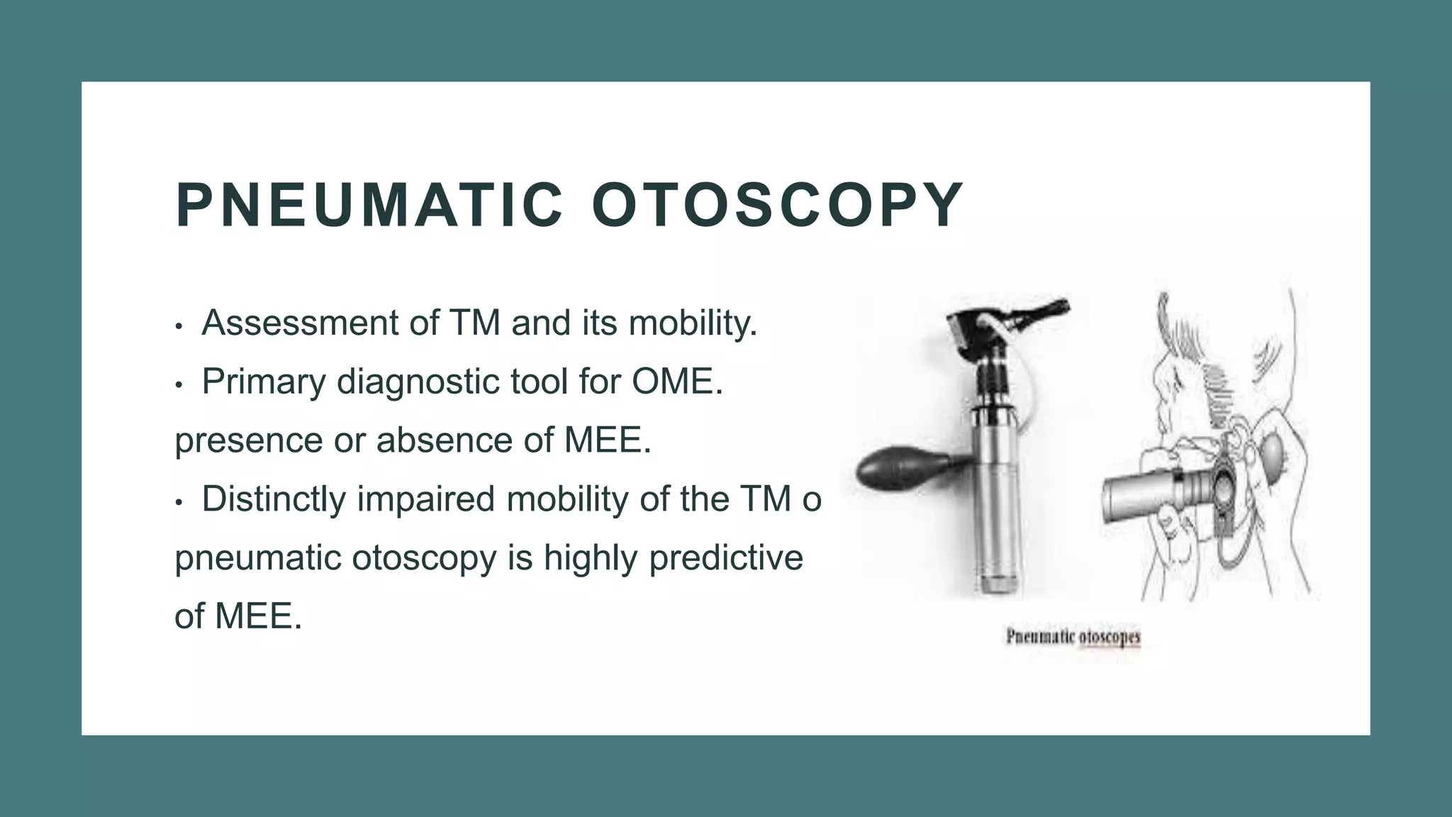 Serous Otitis media and Grommets | PPTX