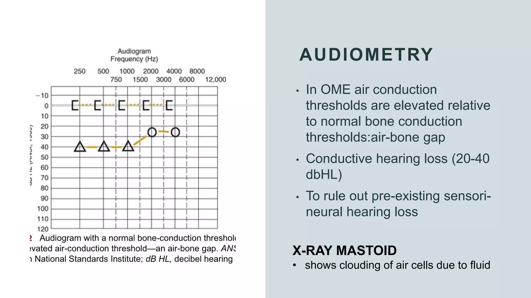 Serous Otitis media and Grommets | PPTX