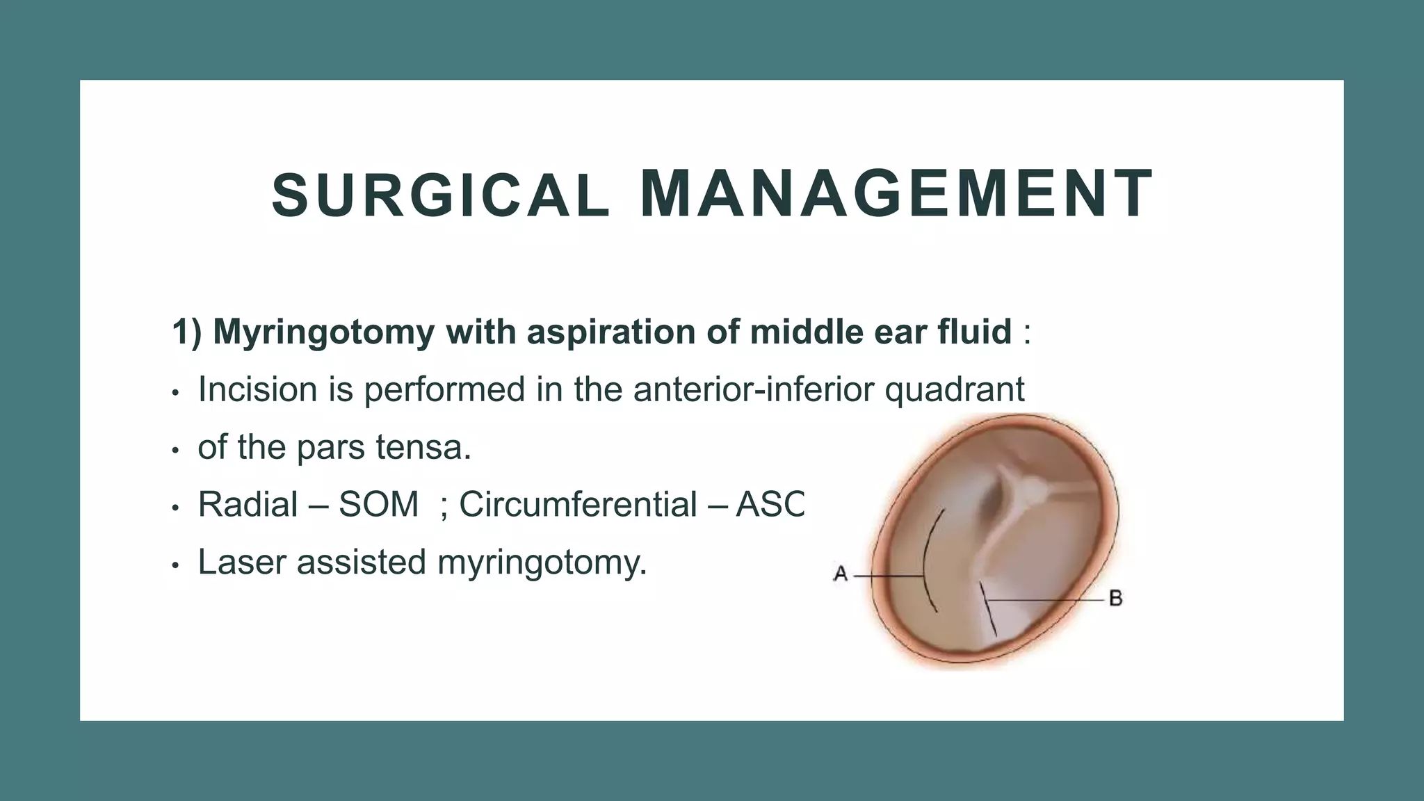 Serous Otitis media and Grommets | PPTX