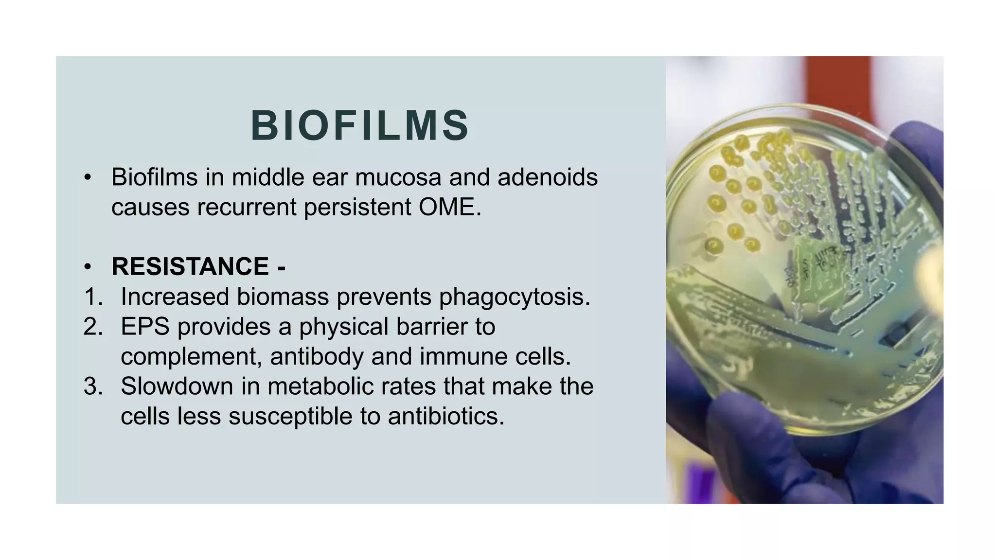 Serous Otitis media and Grommets | PPTX