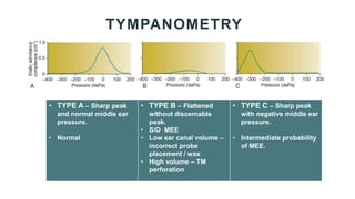 Serous Otitis media and Grommets | PPTX