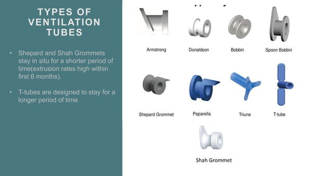 Serous Otitis media and Grommets | PPTX