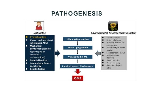 Serous Otitis media and Grommets | PPTX