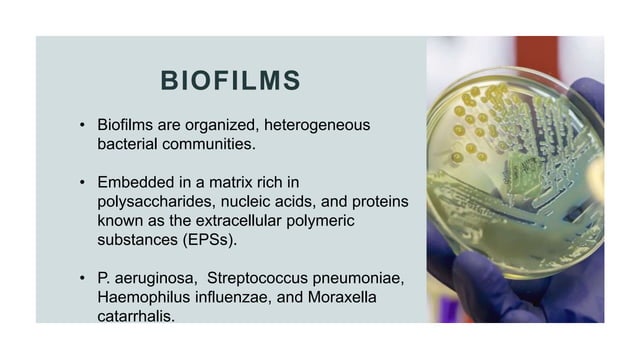 Serous Otitis media and Grommets | PPTX