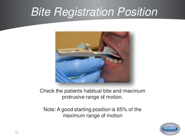 SomnoMed How to Guide: Impressions and Bite Registrations