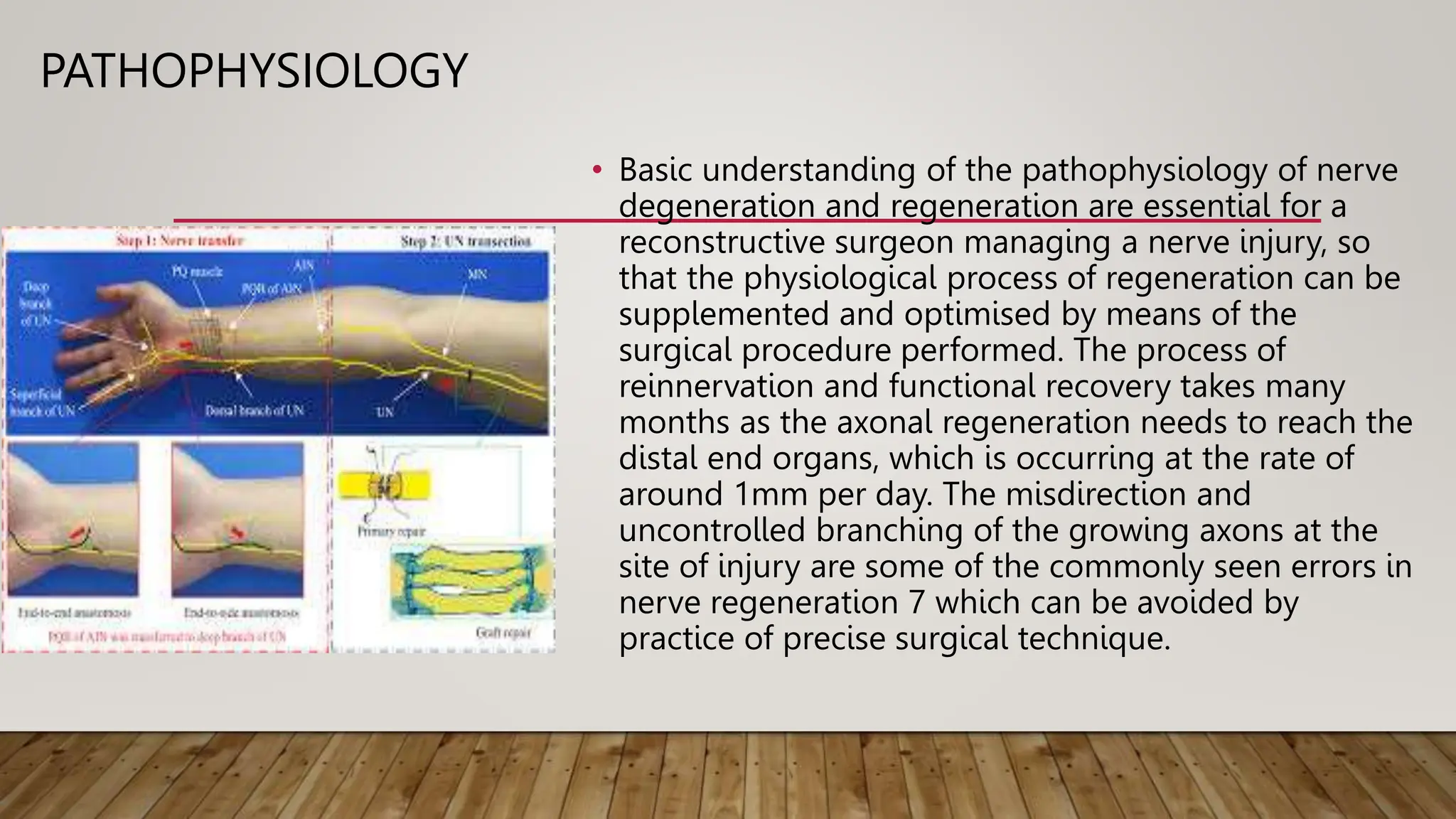 Suture of peripheral nerve .This is a ppt about peripheral nerve suture ...