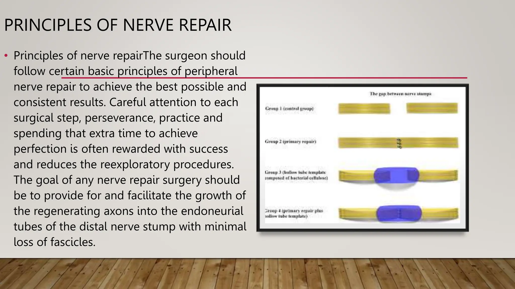 Suture of peripheral nerve .This is a ppt about peripheral nerve suture ...