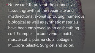Suture of peripheral nerve .This is a ppt about peripheral nerve suture ...