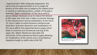 Suture of peripheral nerve .This is a ppt about peripheral nerve suture ...