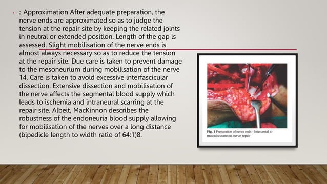 Suture of peripheral nerve .This is a ppt about peripheral nerve suture ...