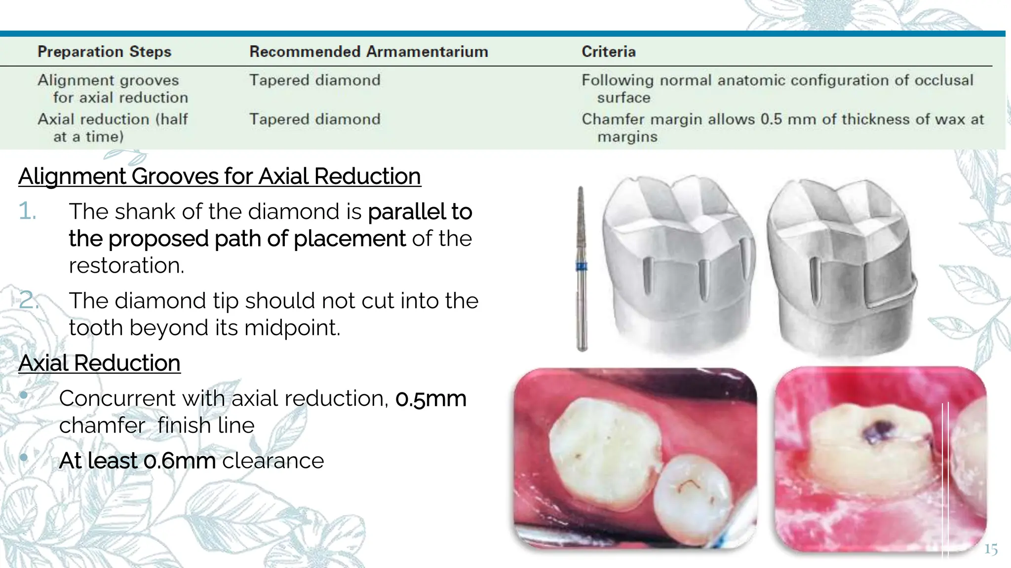 preparation for full coverage restorations .pptx