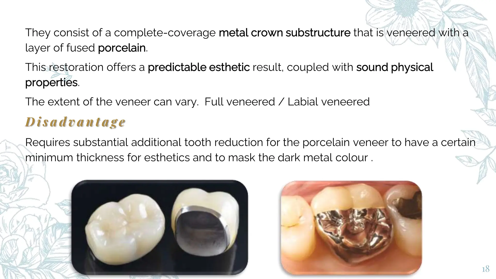 preparation for full coverage restorations .pptx