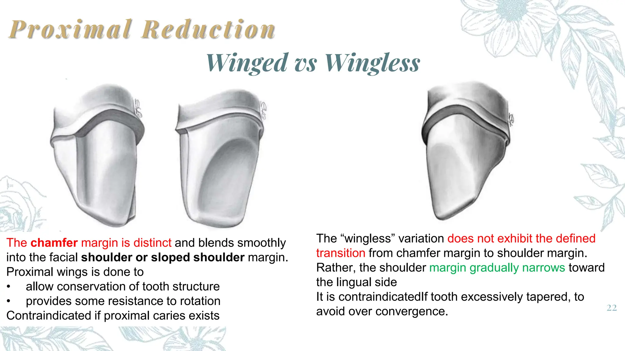preparation for full coverage restorations .pptx