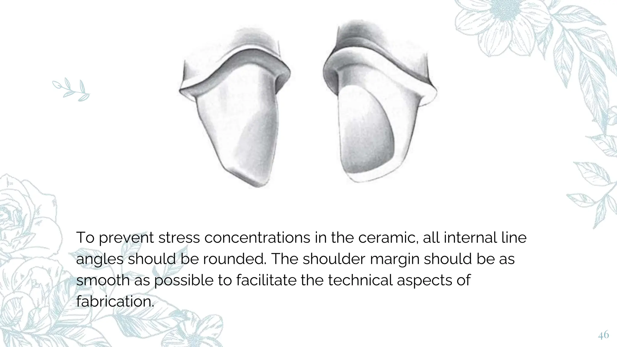 preparation for full coverage restorations .pptx