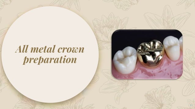 preparation for full coverage restorations .pptx