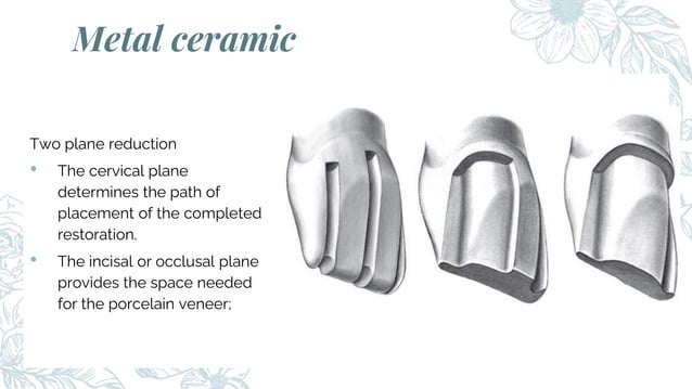 preparation for full coverage restorations .pptx
