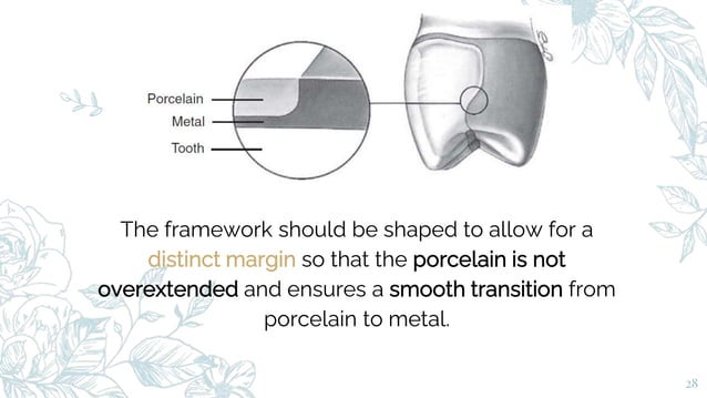 preparation for full coverage restorations .pptx