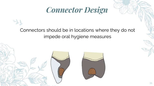 preparation for full coverage restorations .pptx