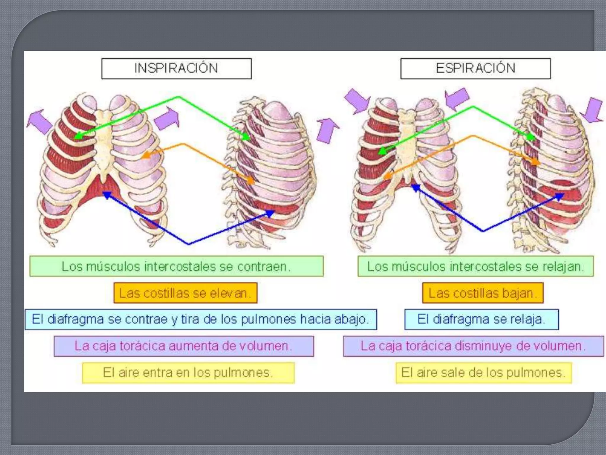 Sonda Endopleural | PPTX