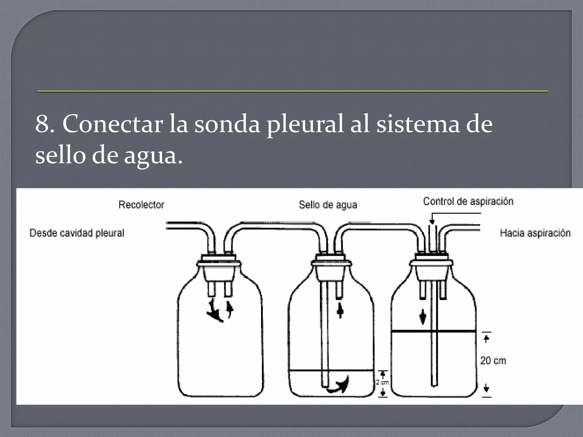Sonda Endopleural | PPTX