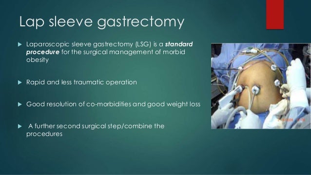 3 Day Military Diet Long-Term Results Of Gastric Sleeve Surgery - cocointer