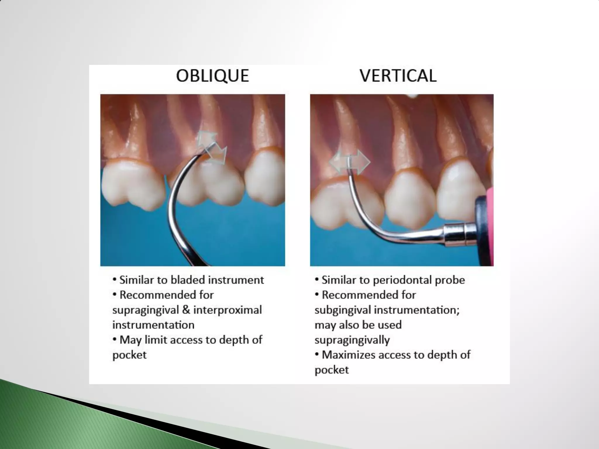 Sonic and ultrasonic scaling | PDF
