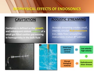 Sonics and ultrasonics in endodontics | PPT