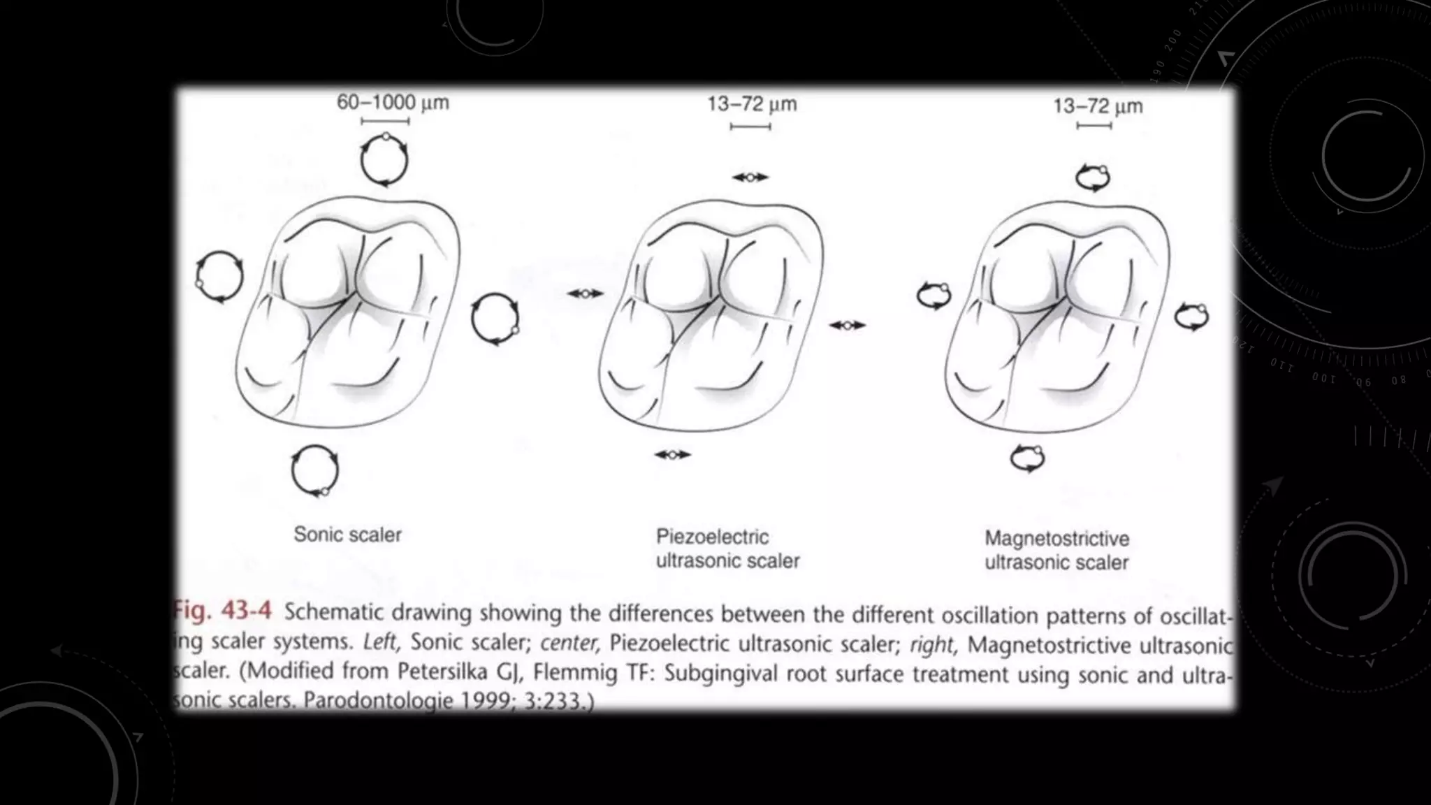Sonic & ultrasonic instruments | PPTX