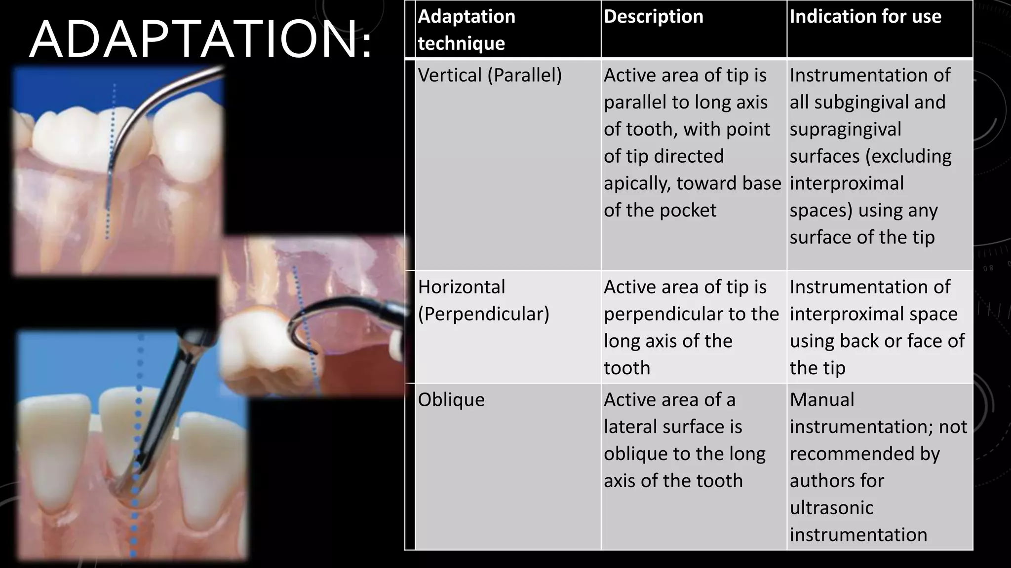Sonic & ultrasonic instruments | PPTX