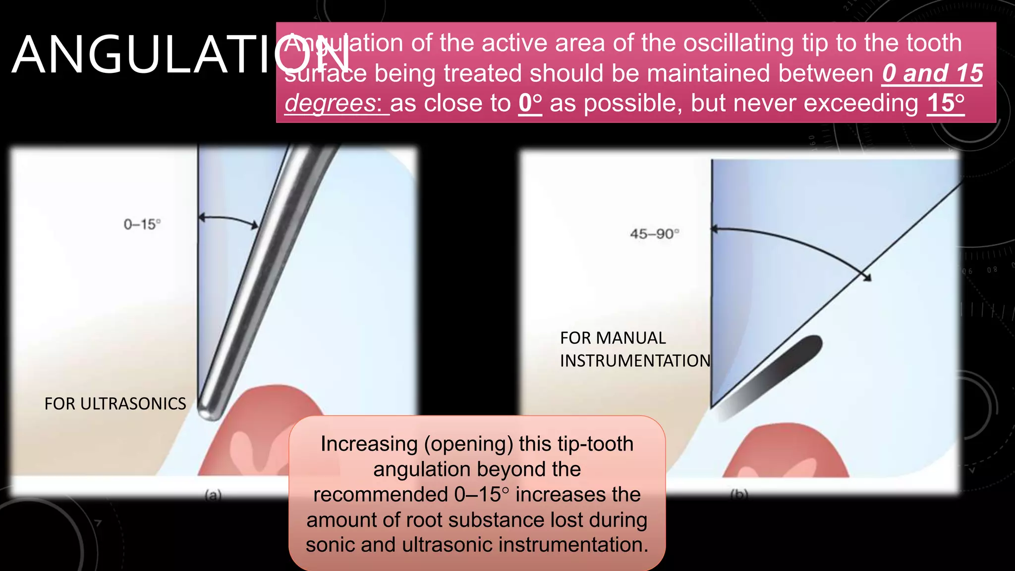 Sonic & ultrasonic instruments | PPTX
