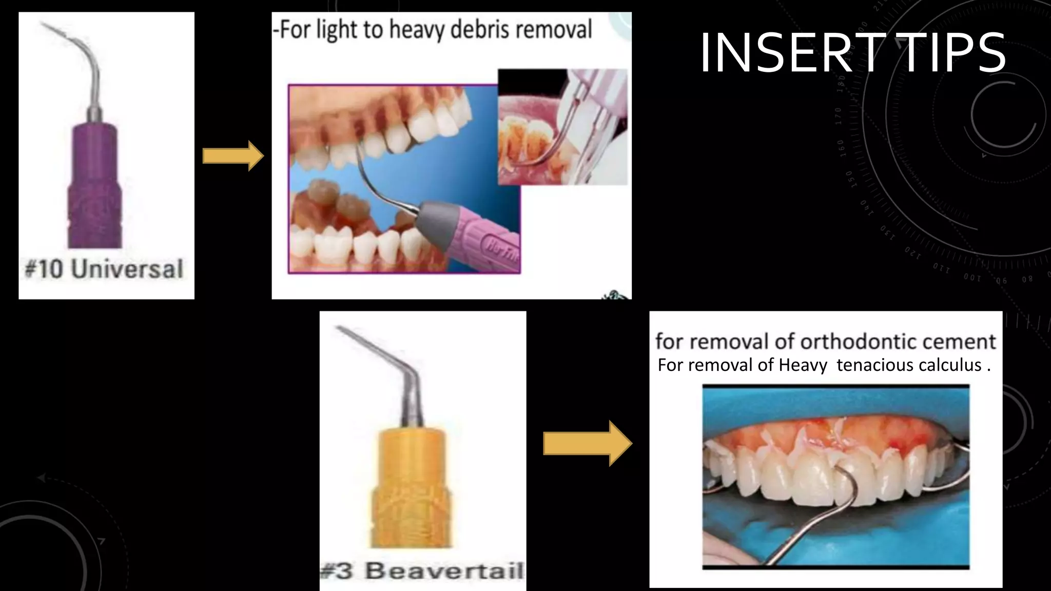 Sonic & ultrasonic instruments | PPTX