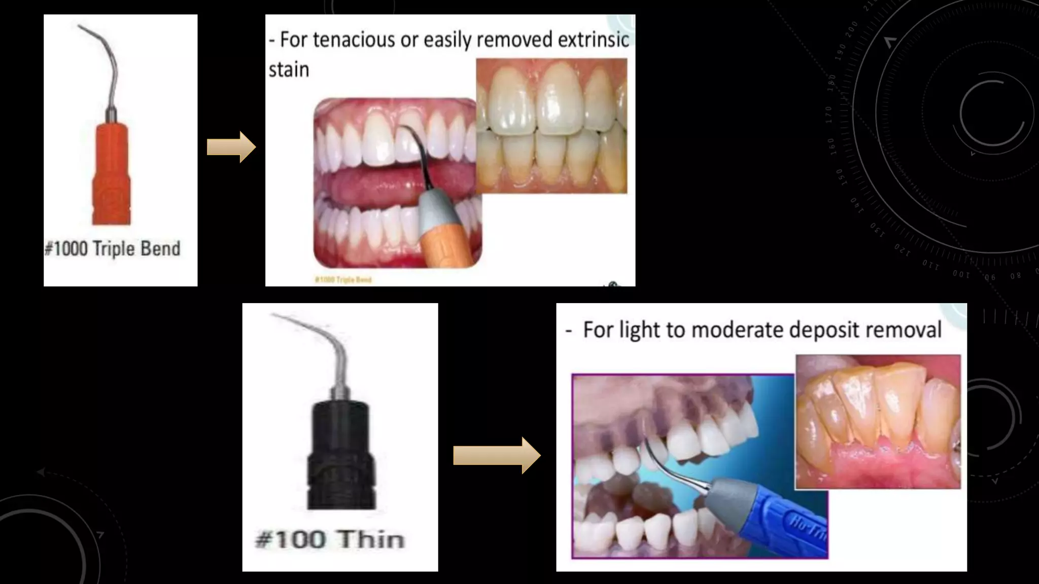 Sonic & ultrasonic instruments | PPTX