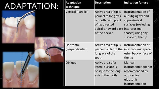 Sonic & ultrasonic instruments | PPTX | Dental Health | Diseases and ...